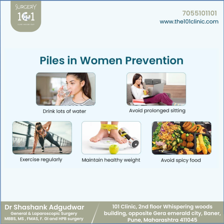 Piles in Women - Causes, Symptoms & Treatment