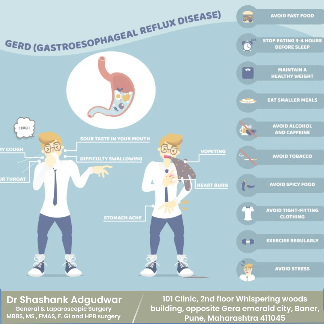 Gastroesophageal Reflux Disease: What Everyone Should Know About GERD
