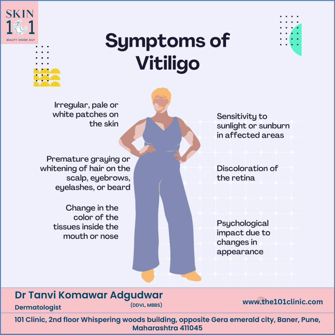Vitiligo﻿﻿: Causes, Risk Factors, Symptoms, Treatment