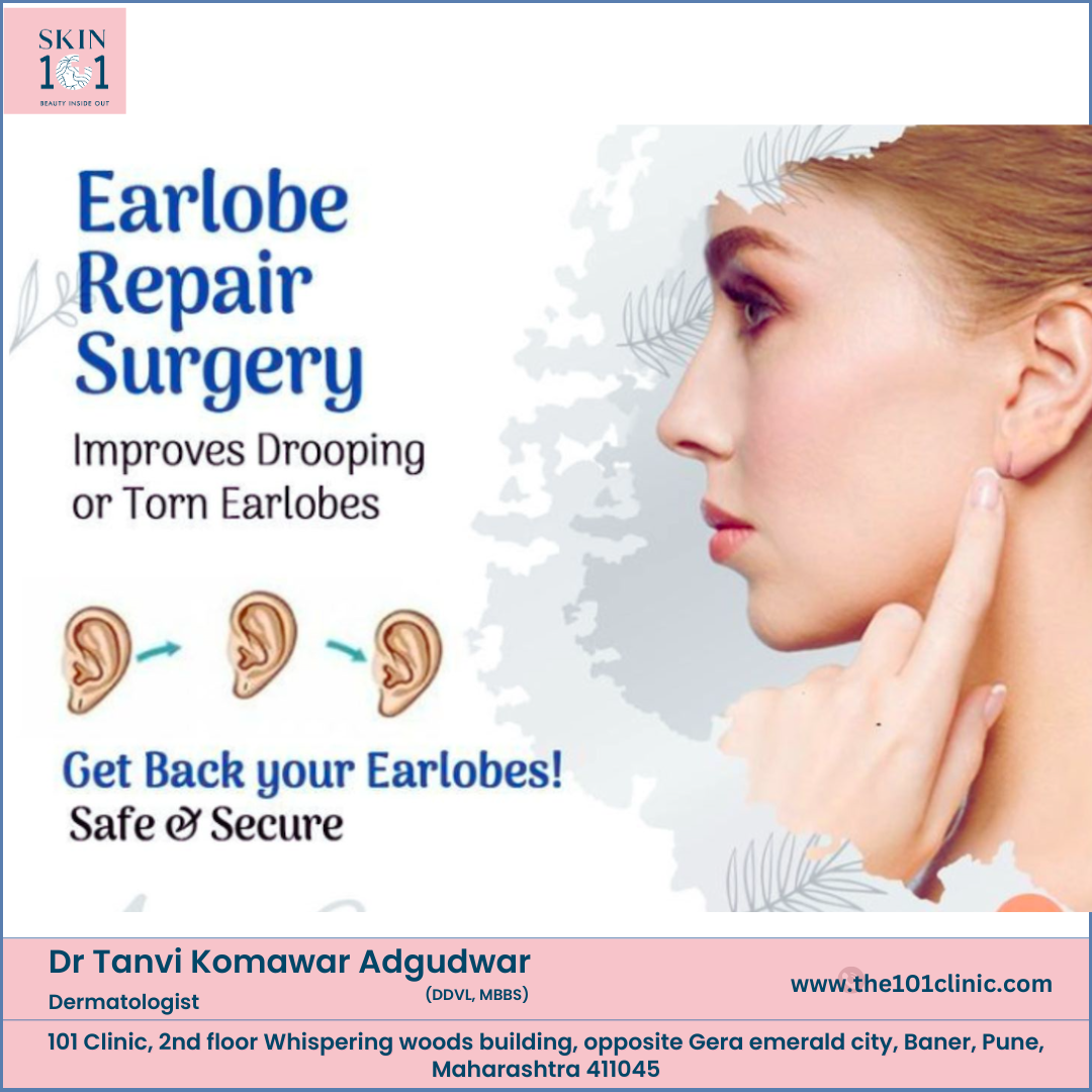 Restore the Beauty of Your Ears with Earlobe Repair Surgery at The 101 ...