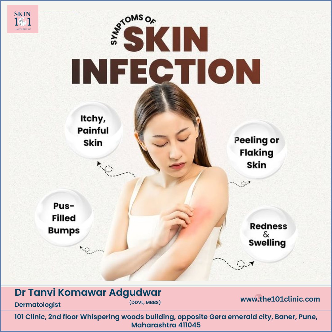 Understanding Skin Infections: Causes, Symptoms & Treatment