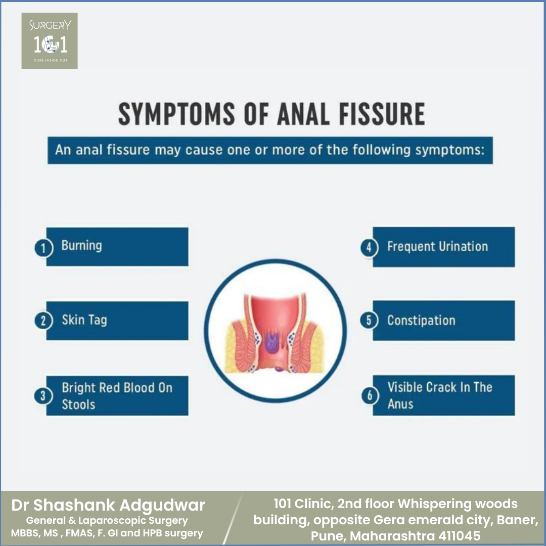 Understanding Anal Fissure – Causes, Symptoms & Treatment