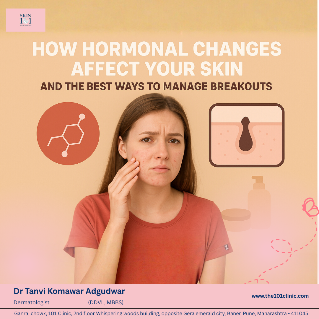 How Hormonal Changes Affect Your Skin | Dr. Tanvi Adgudwar | Skin ...