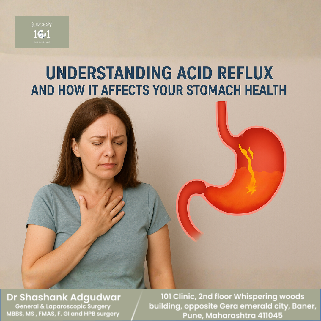 Understanding Acid Reflux & Stomach Health Guide | Dr. Shashank Adgudwar