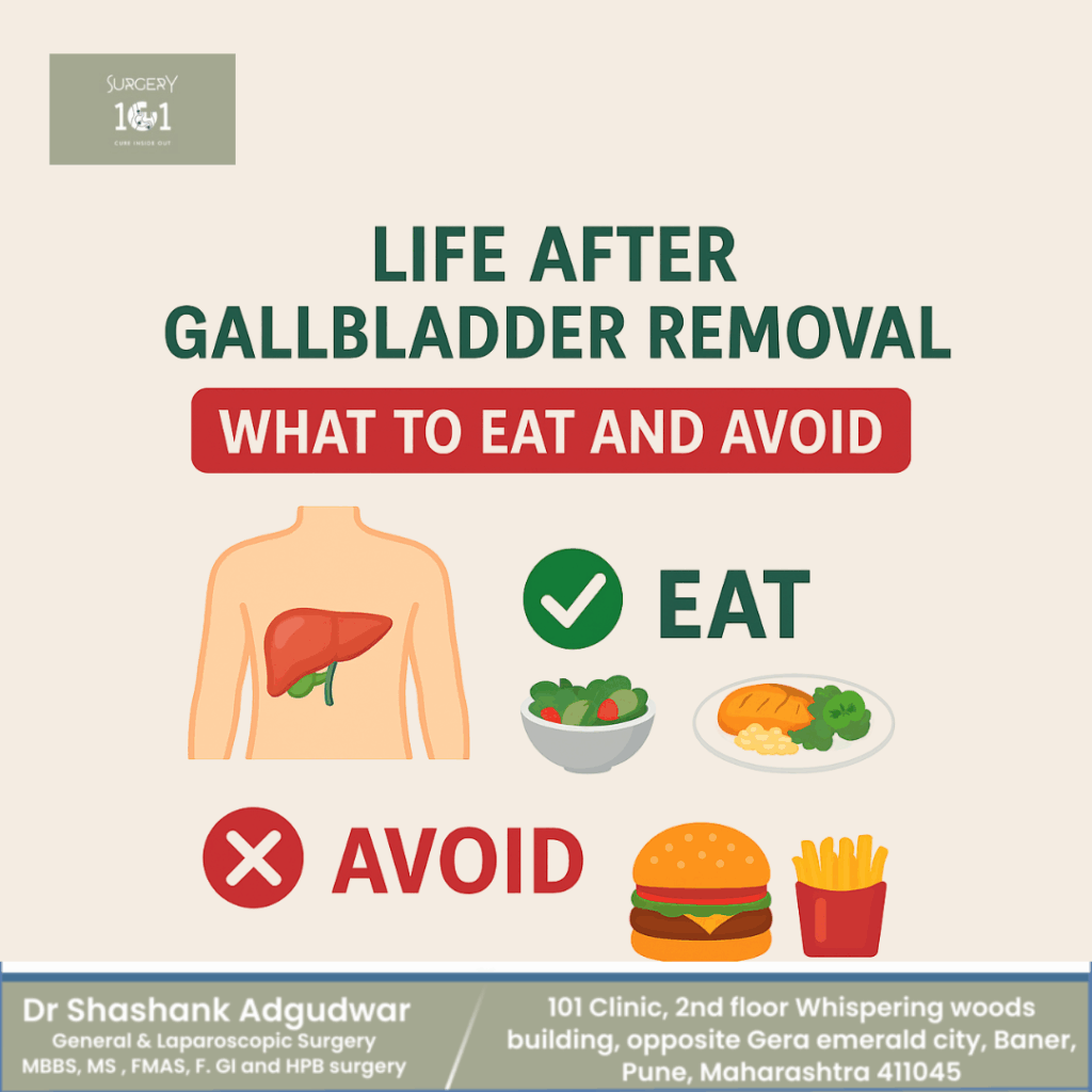 Life After Gallbladder Removal: Diet Tips & Guide | Dr Shashank Adgudwar