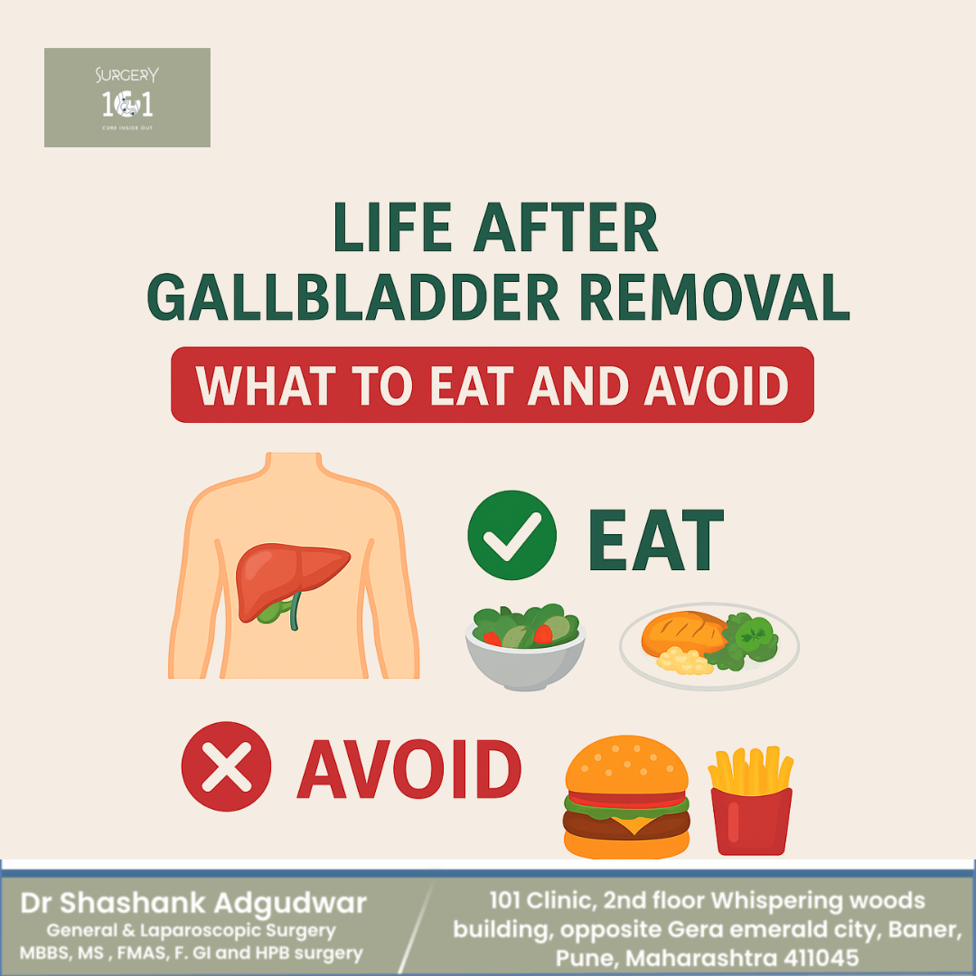 Life After Gallbladder Removal: Diet Tips & Guide | Dr Shashank Adgudwar